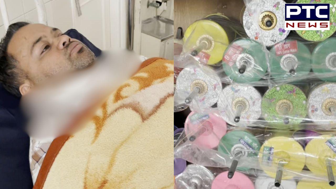 China Dor : ਖਤਰਨਾਕ ਚਾਈਨਾ ਡੋਰ ਨੇ ਵਿਅਕਤੀ ਦਾ ਵੱਢਿਆ ਗੱਲ੍ਹ, ਬੁਰੀ ਤਰ੍ਹਾਂ ...